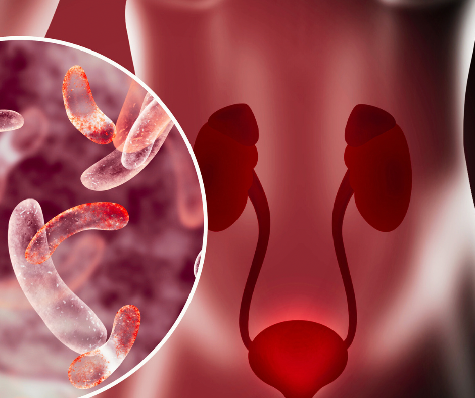 O que é a Infecção do Trato Urinário? - Clínica Martinelli